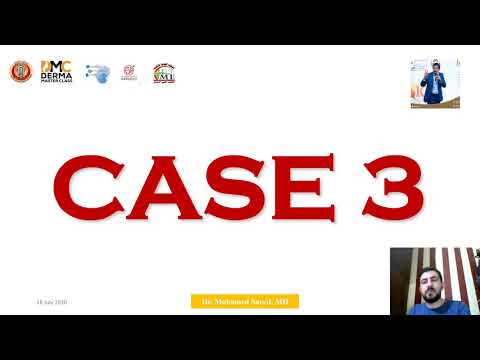 dermoscopy scenarios part 1