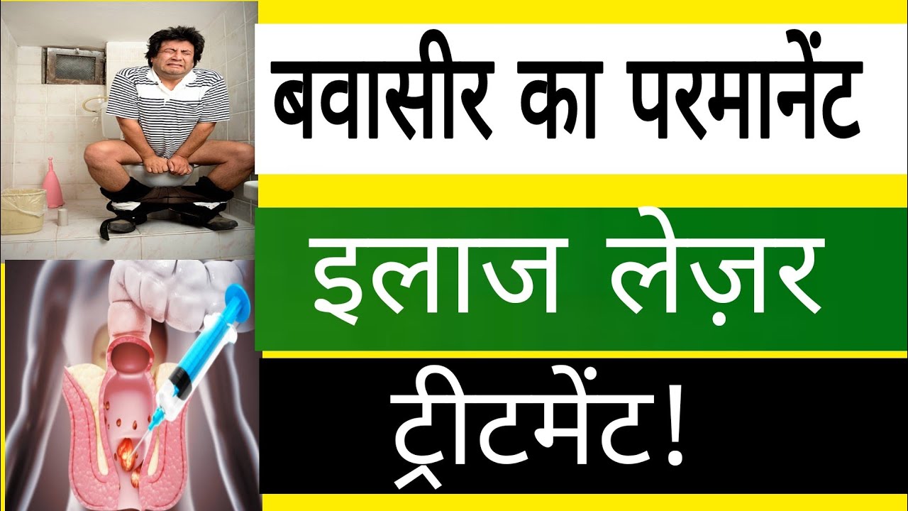 बवासीर का पूरा और पक्का इलाज लेज़र ट्रीटमेंट! bawasir ka ilaj |bawasir ...