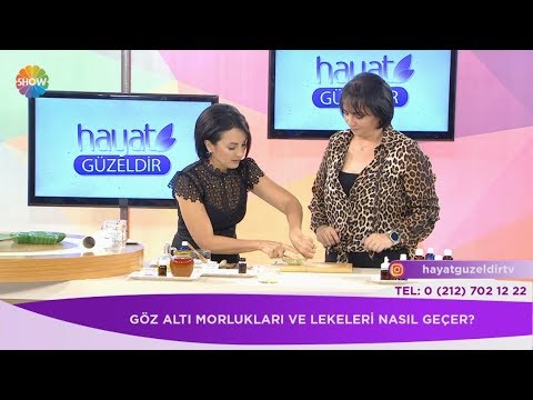 Hayat Güzeldir 76. Bölüm