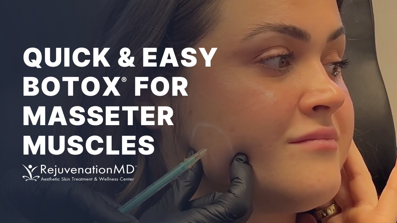 Relieve Headaches and Teeth Grinding with Botox - YouTube