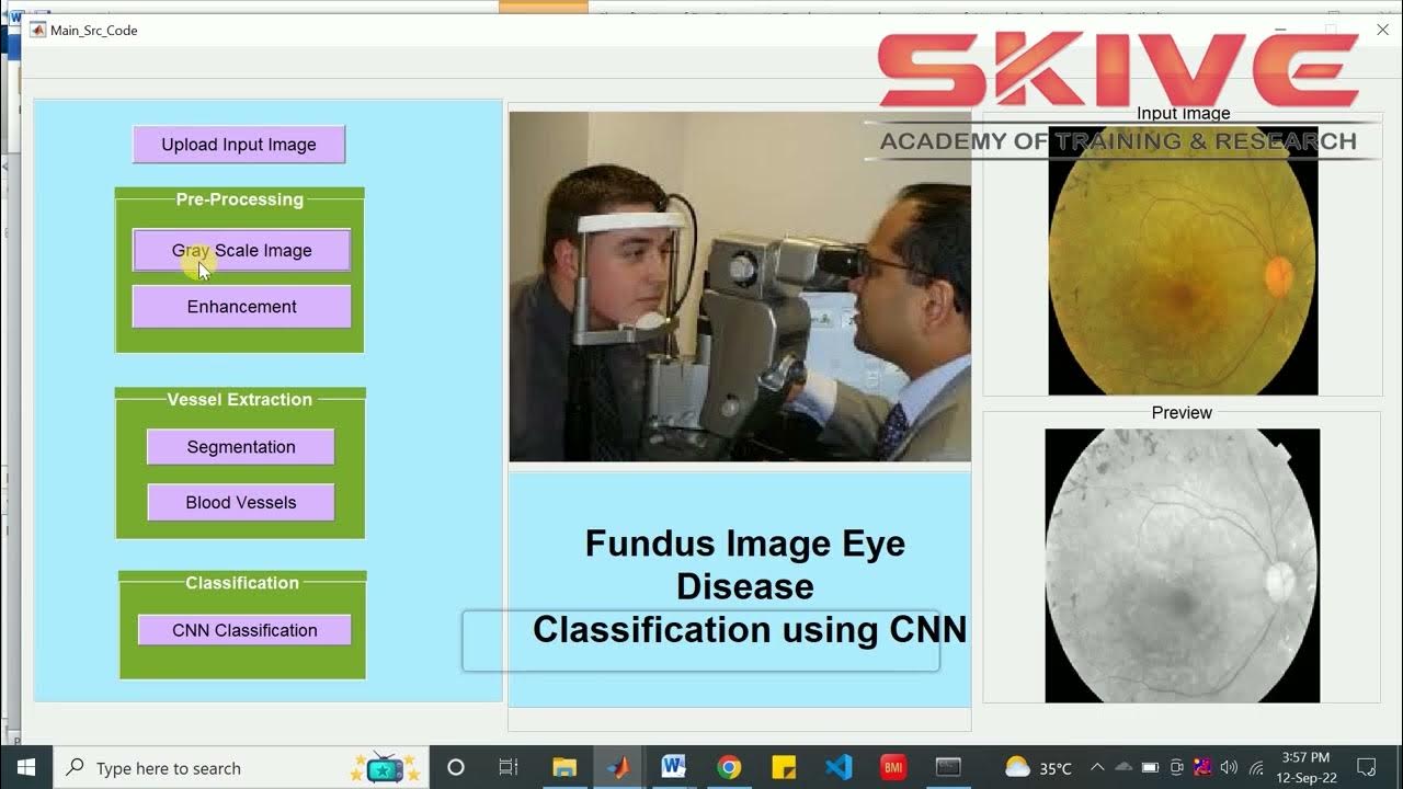 Classification of Eye Diseases in Fundus Images Using Deep Learning | # ...