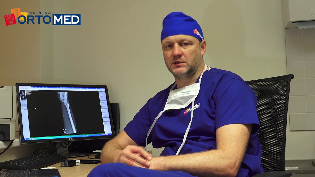 Dr. Vugulis- Kas ir plaukstas locītavas ganglija cistas? - YouTube