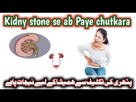 kidny stone se ab Paye chutkara - YouTube