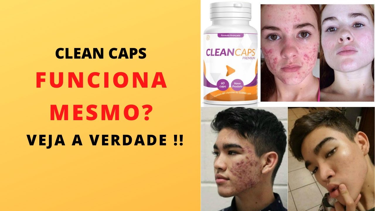 Clean Caps Funciona Mesmo? Clean Caps Para Que Serve? Clean Caps tem ...