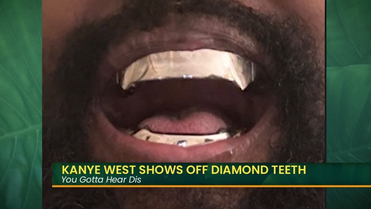 You Gotta Hear Dis: Kanye West's new set of teeth - YouTube
