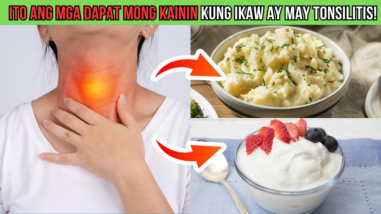 TOP 5 PAGKAIN na DAPAT KAININ ng TAONG may TONSILITIS! - YouTube