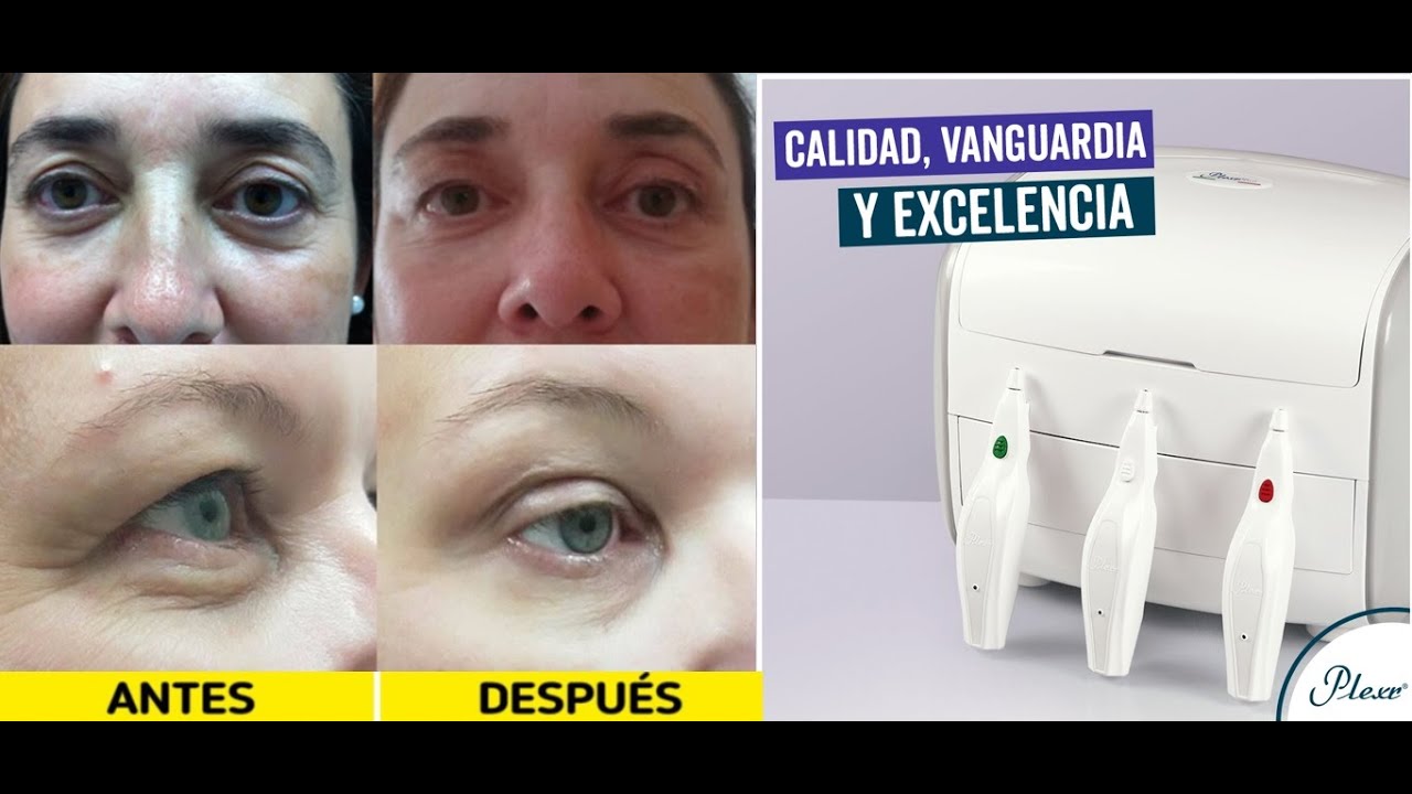 Prosalud TV : Tecnologia innovadora en medicina estética llamada Plexr ...