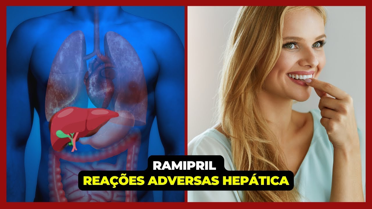Ramipril efeito colateral no fígado #hipertensãoarterial #saudebemestar ...