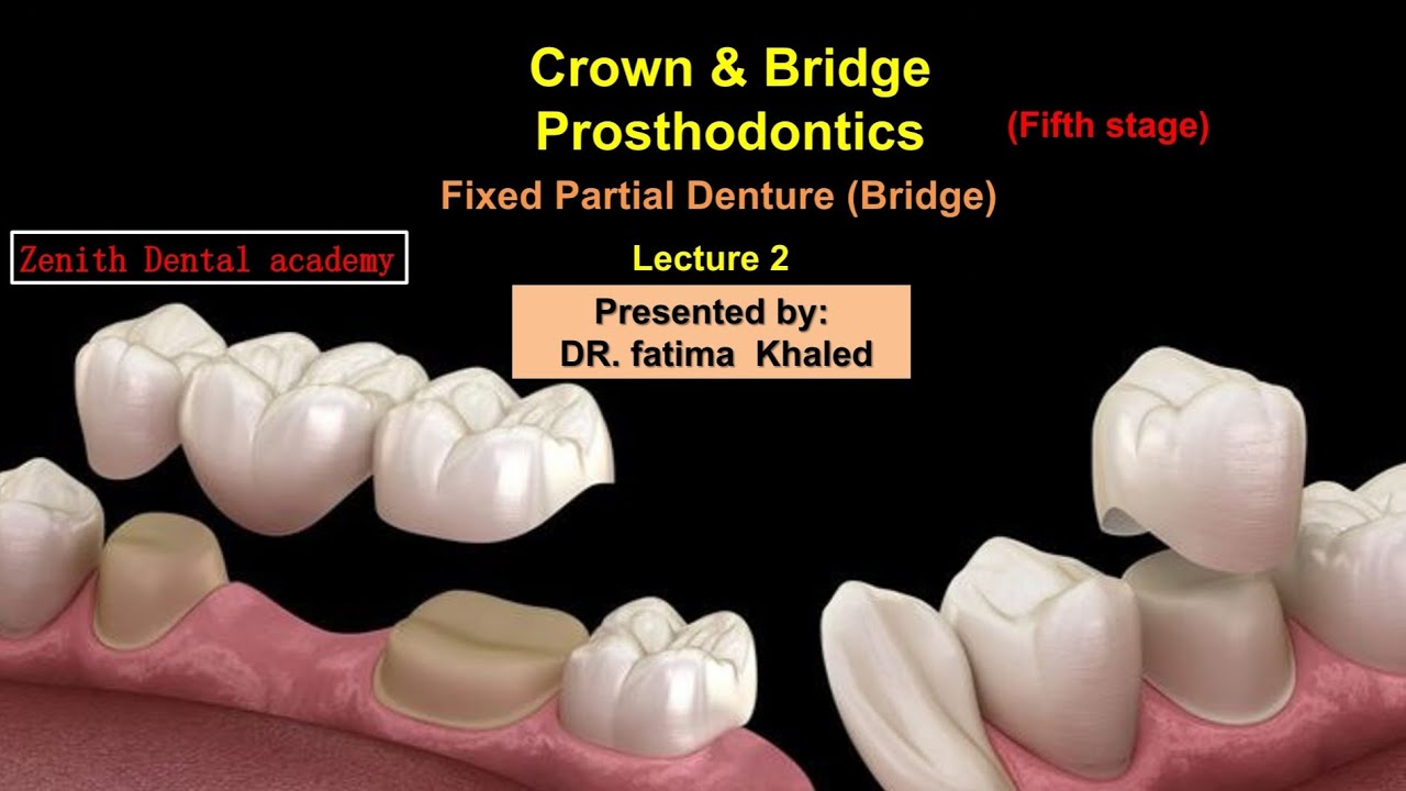Crown and bridge lec.2(Part 1) - YouTube