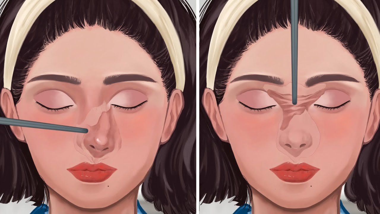 ASMR shocking makeup transformation|Best beauty makeover - YouTube