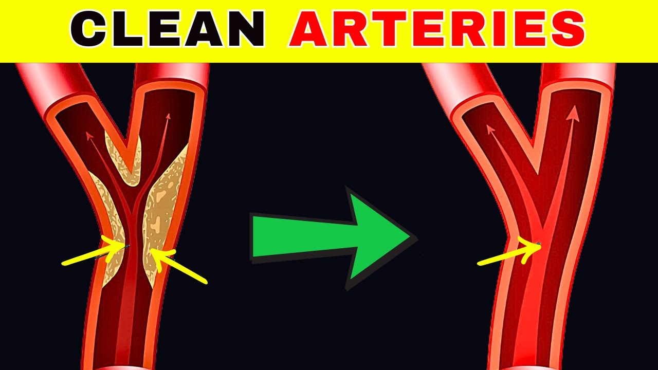5 Best Vegetables to Clean Your Arteries & Prevent Heart Attacks! - YouTube