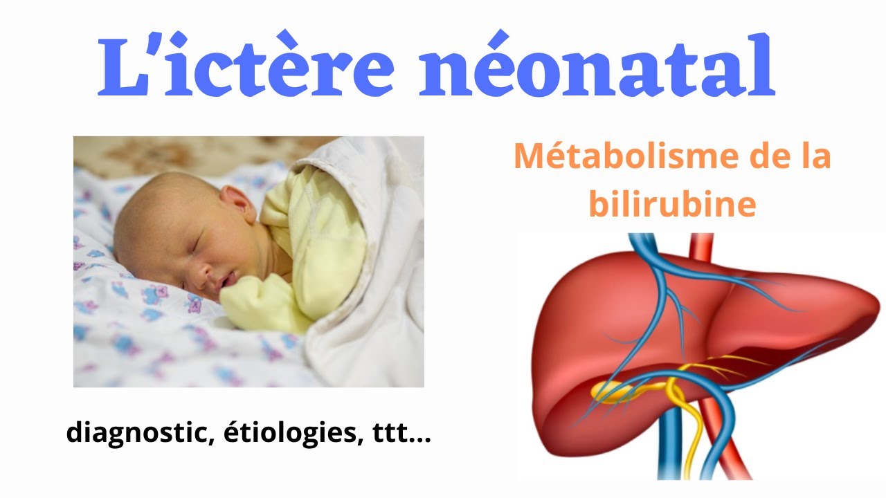 l'ictère Néonatal - YouTube