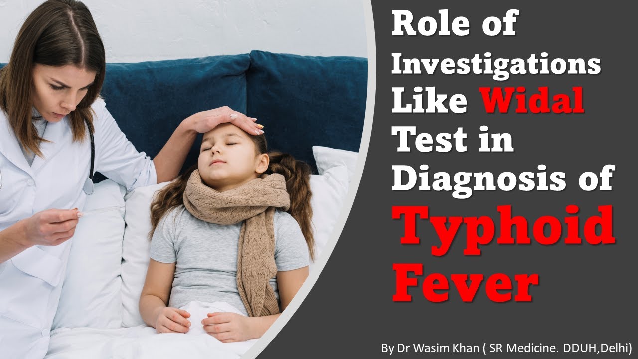 Role of Investigations Like Widal Test in Diagnosis of Typhoid Fever By ...