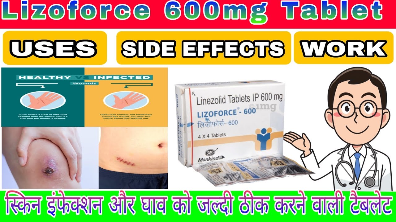 Lizoforce 600mg Tablet स्कीन इंफेक्शन और जाखम घाव को ठीक करने बाली ...