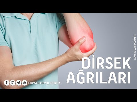 Dirsek ağrıları neden olur? | Prof. Dr. Yakup YILDIRIM