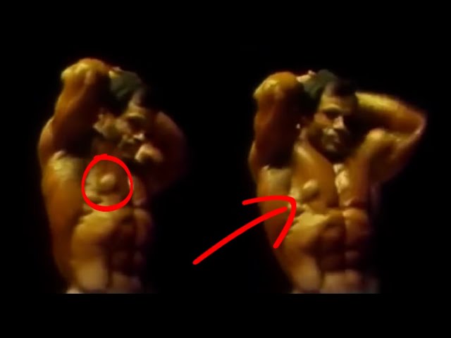Bodybuilder Celebrities With Gynecomastia 60 Photos - Moonagedaydream.film