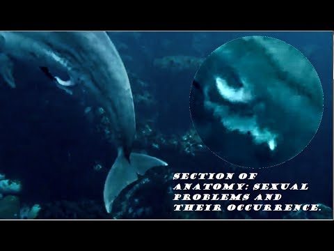 The Dolphin has an involuntary ejaculation. Orgasm, Severe release of climax sperm from Dolphin.