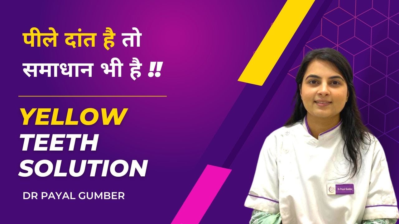 पीले दांत है तो समाधान भी है !! | Yellow Teeth Solution | Dr. Payal ...