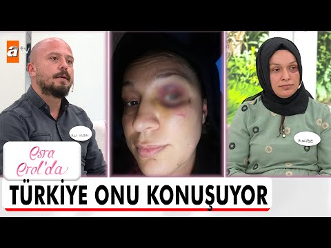 Dayakçı koca canlı yayında! - Esra Erol'da 7 Haziran 2023