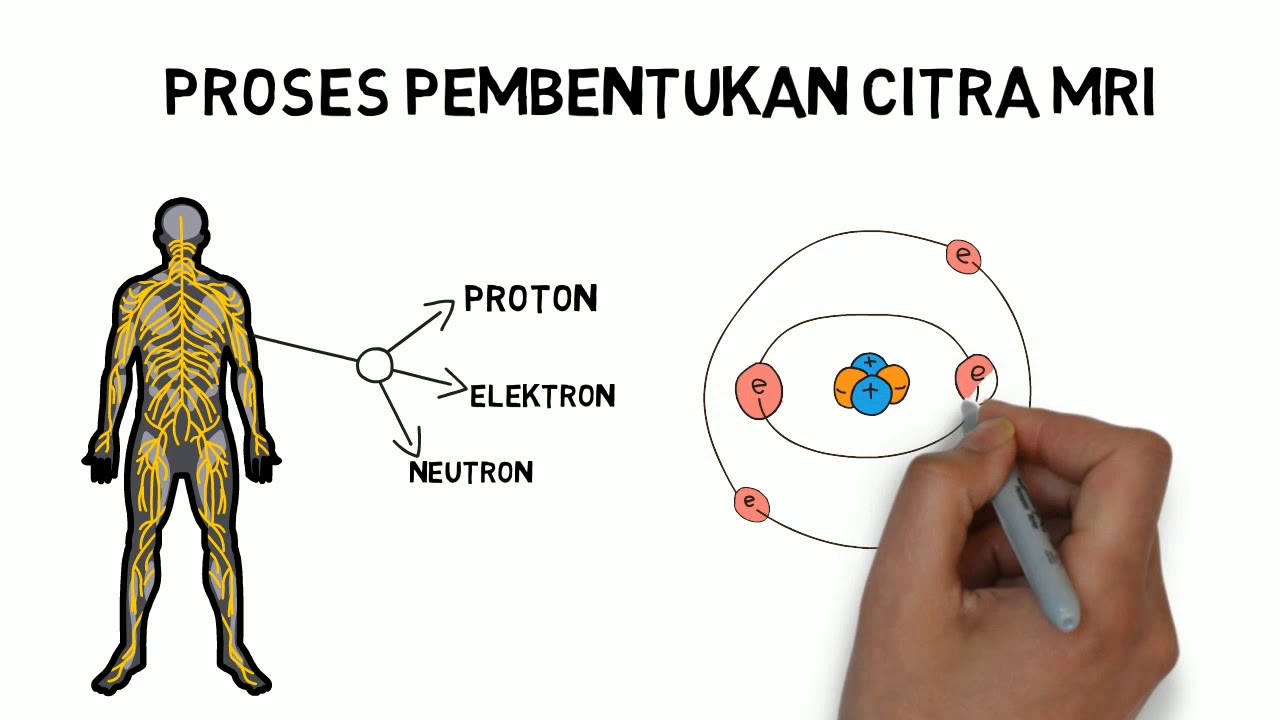 Komponen Dan Proses Pembentukan Citra MRI - YouTube