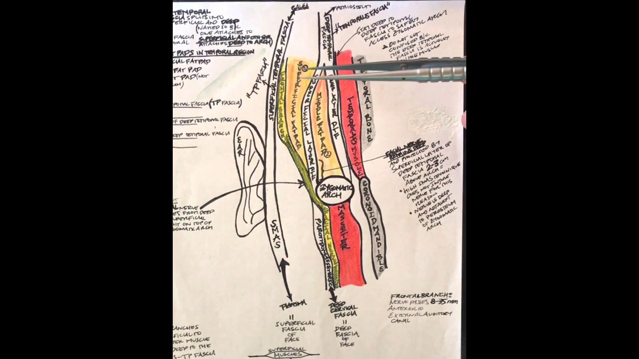 Face Lift Anatomy (Layers of Face / Facelift Anatomy) - YouTube