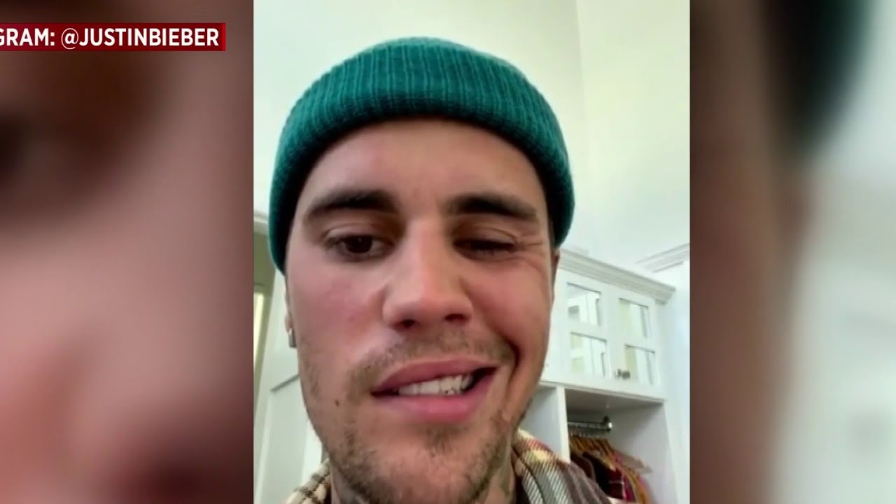 Singer Justin Bieber diagnosed with Ramsay Hunt syndrome, says half his ...