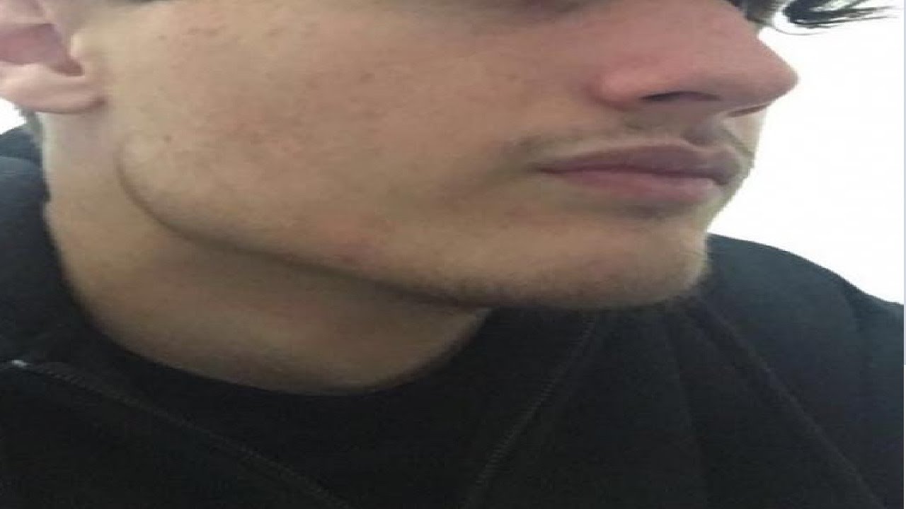 how to mew while you sleep - YouTube