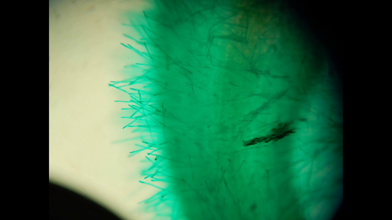 root hairs - YouTube