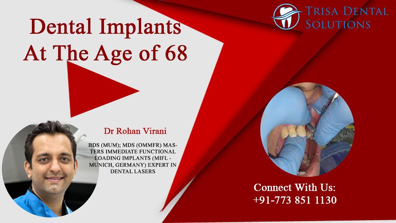 Dental Implants At The Age of 68 | क्या ६८ की उम्र में DENTAL IMPLANTS ...
