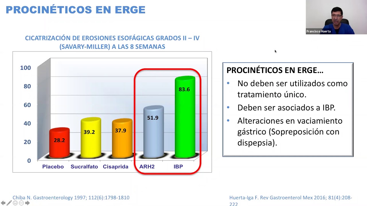 Procinéticos en ERGE y dispepsia funcional - YouTube