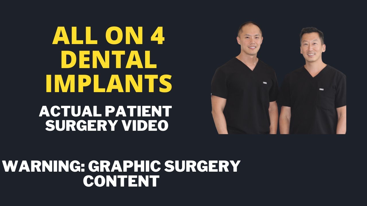 All on 4 Dental Implant Patient Surgery Video. How We Plan and Perform ...