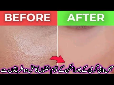 Repair Your Skin After a Long Summer Disaster - Remove Dullness, Acne ...