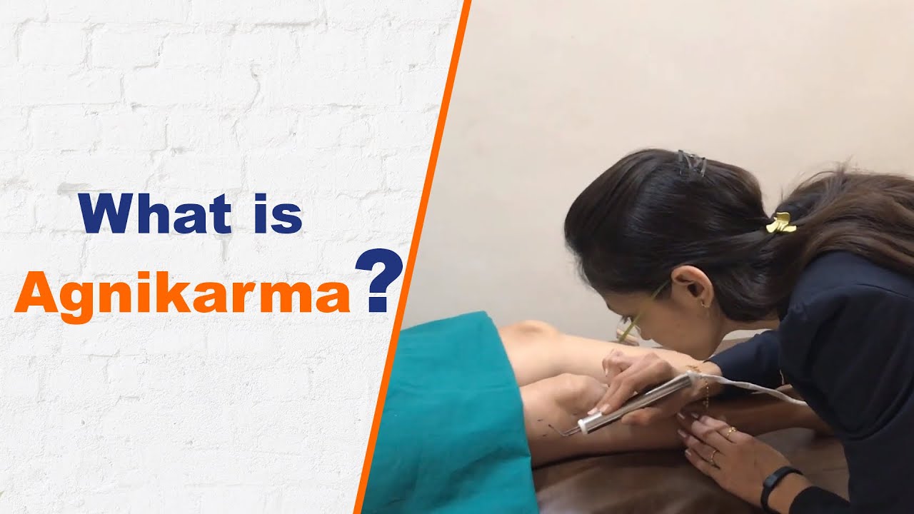 क्या हे अग्निकर्म चिकित्सा ? | What is Agnikarma Treatment? | Are you ...