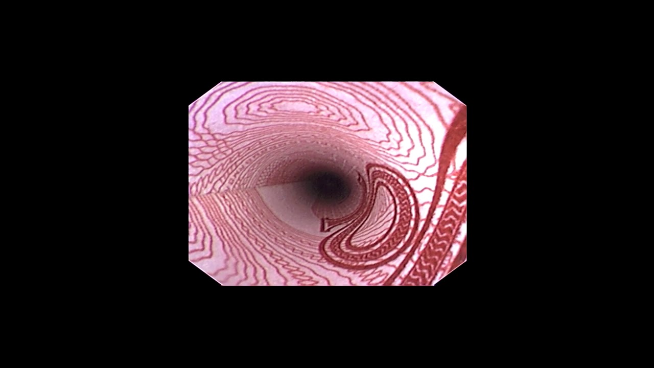 Image cystoscope WiScope 400 x 400 pixels !! - YouTube