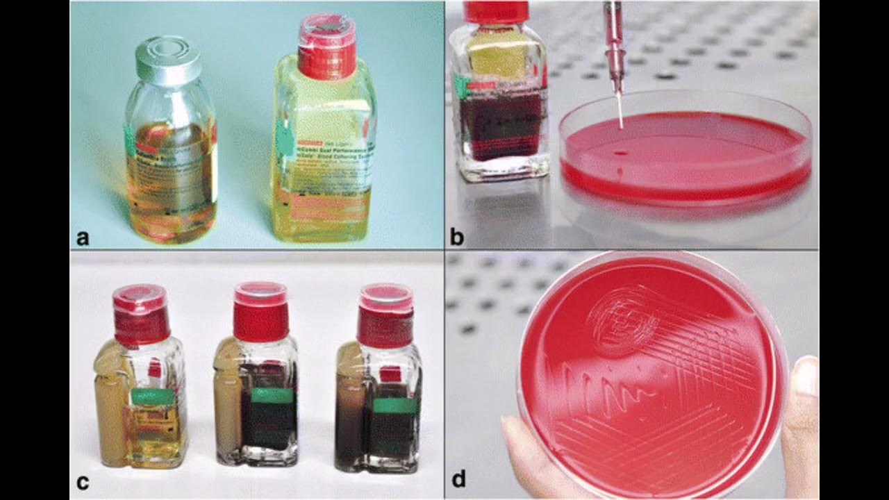 Specimen Selection and Collection General Considerations | MEDICAL ...
