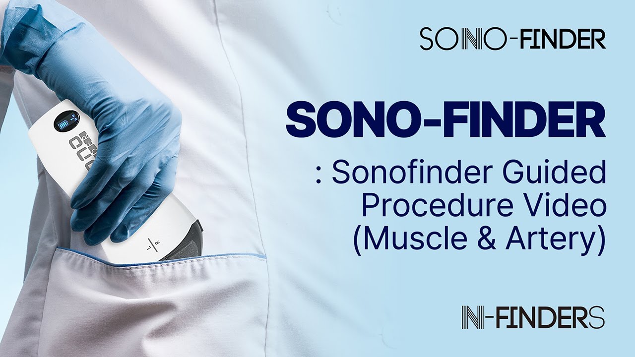 SONO-Finder Guided Procedure Video Muscle & Artery - YouTube