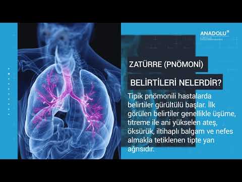 Zatürre Pnömoni Nedir? Zatürre (Pnömoni) Belirtileri Nelerdir?