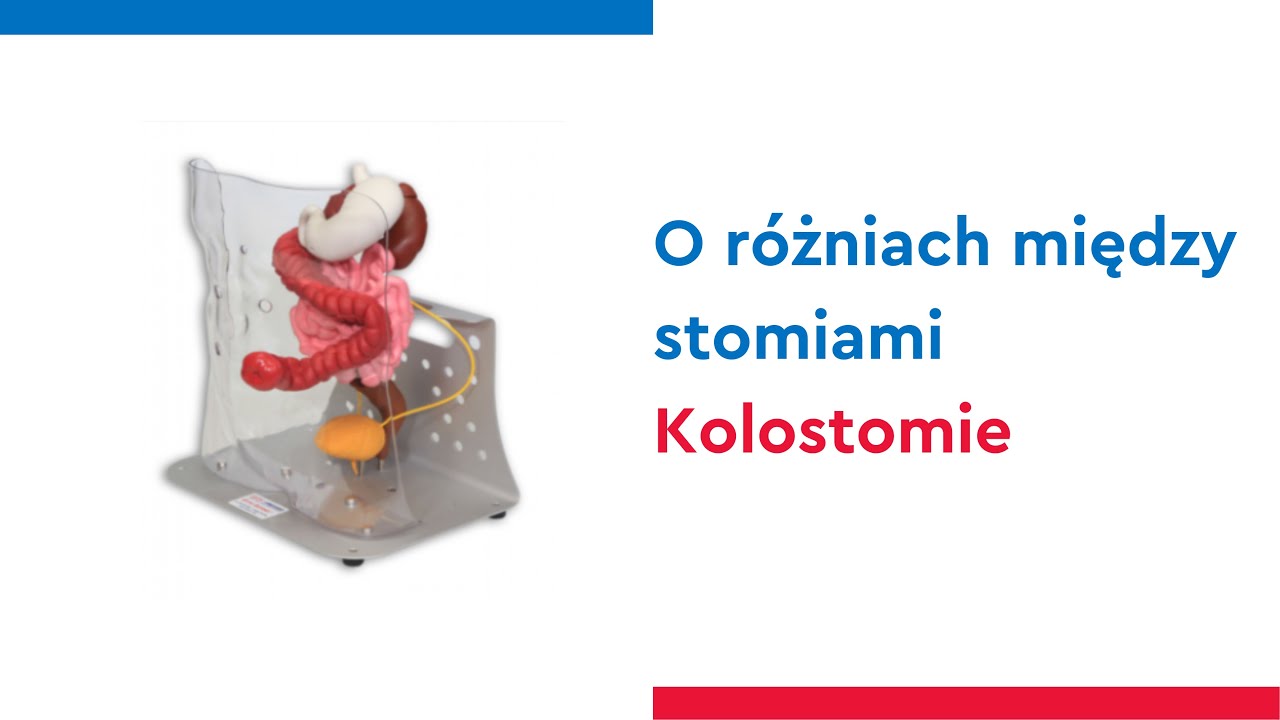 O różnicach między stomiami: Kolostomie - YouTube