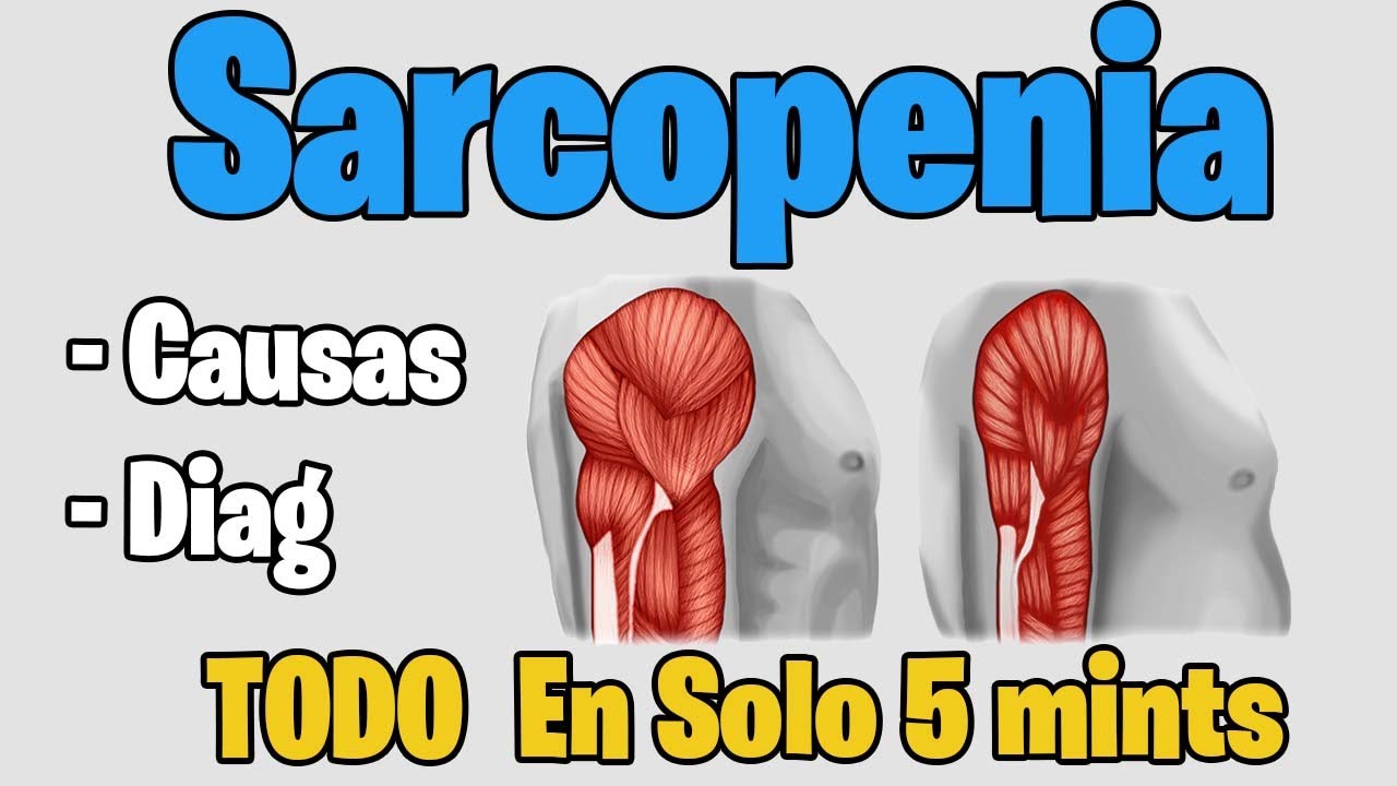 SARCOPENIA | Conoce los sintomas y TRATAMIENTO | perdida de masa ...