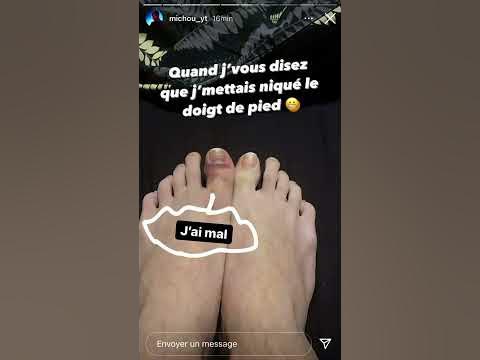 Michou filme son doigt de pied cassé - YouTube