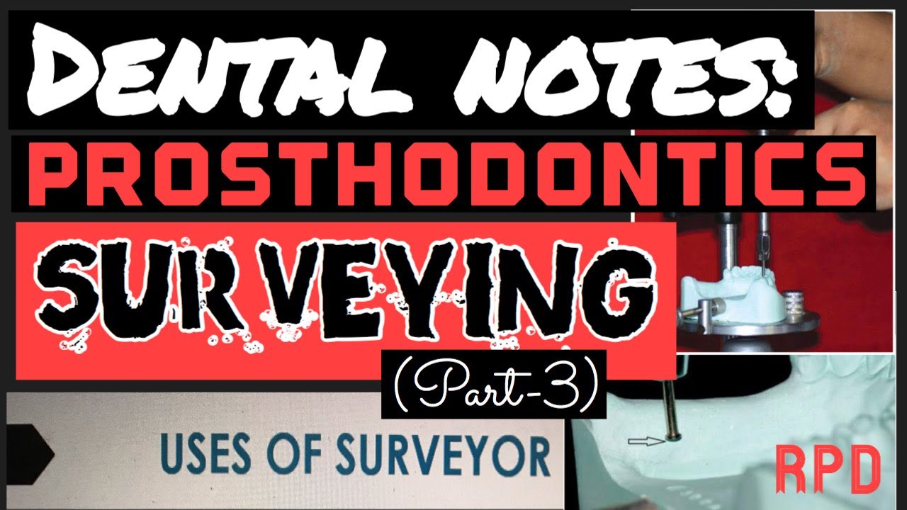 USES OF SURVEYOR II SURVEYING II PROSTHODONTICS II REMOVABLE PARTIAL ...