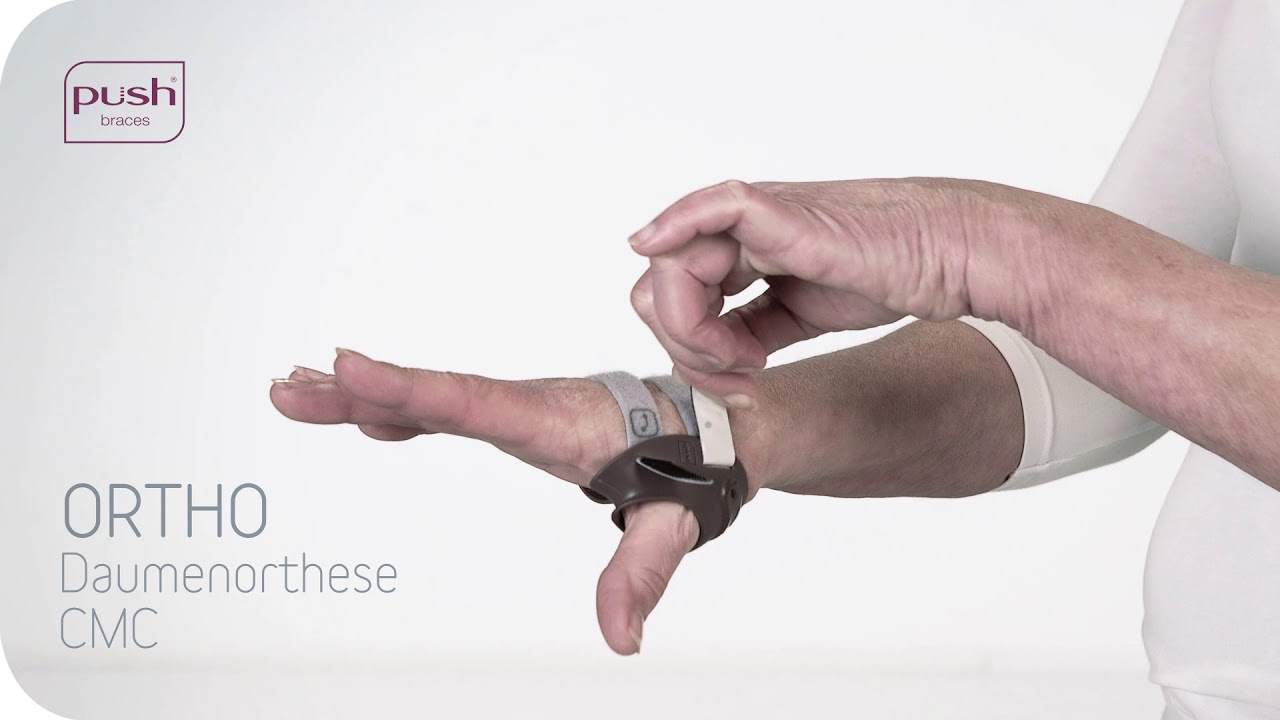 Push Braces | Push ortho Daumenorthese CMC - YouTube