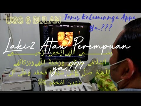 ||Hasil USG 6 bulan Kehamilan|| dengan Alat tercanggih 4D. - YouTube