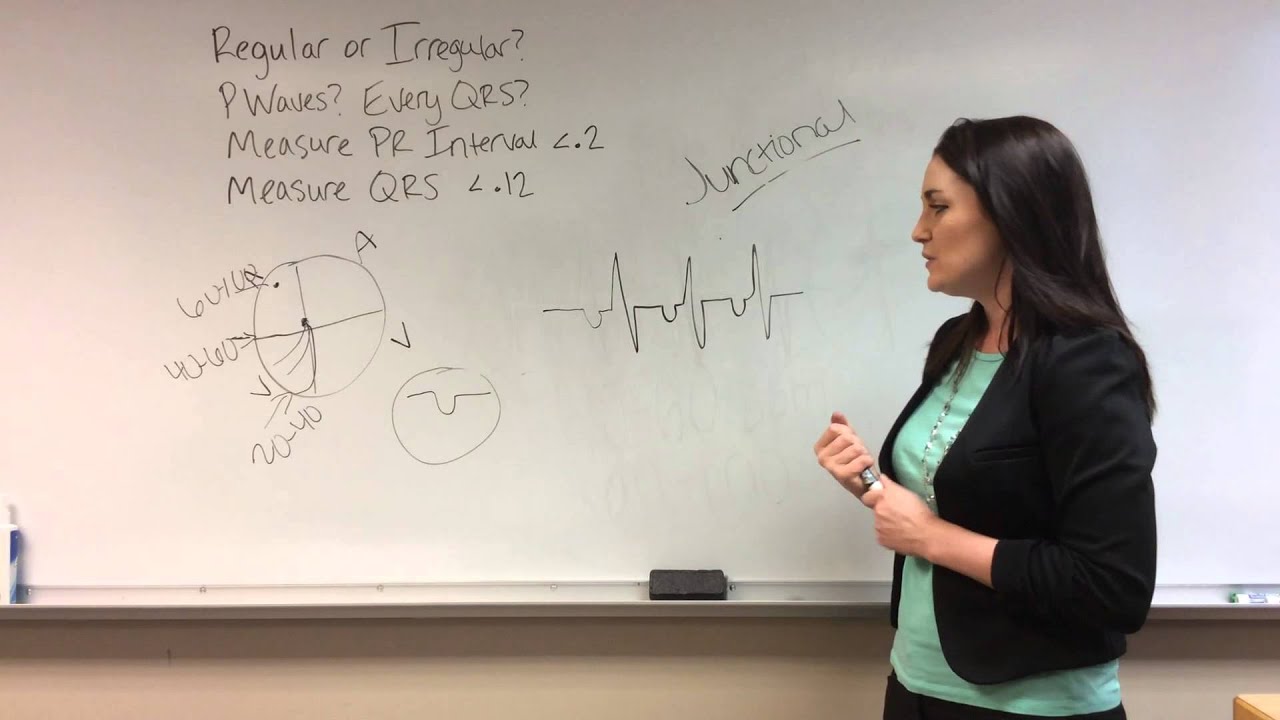 Cardiac Rhythm Analysis - Video 2 of 3 - YouTube