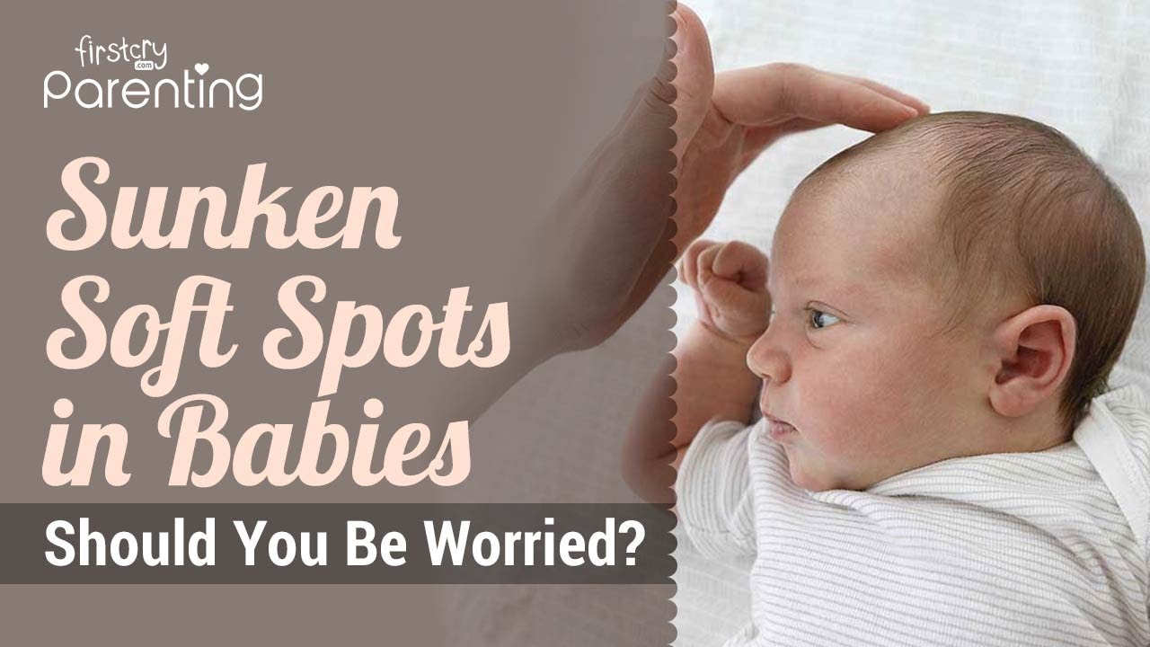 Sunken Soft Spots in Babies - Should You Be Worried? - YouTube