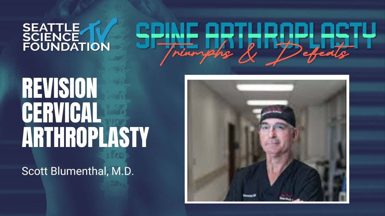 Revision Cervical Arthroplasty – Scott Blumenthal, MD - YouTube