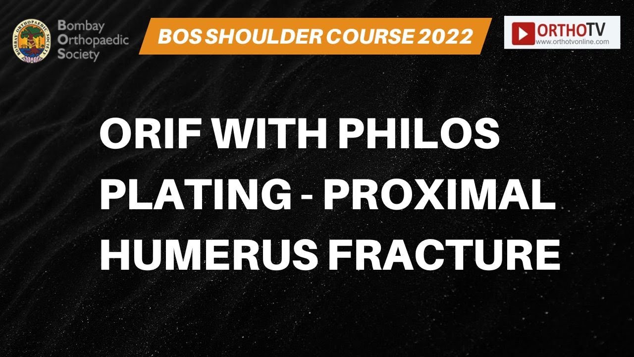 BOS SHOULDER COURSE 2022 : ORIF with Philos Plating - Proximal Humerus ...