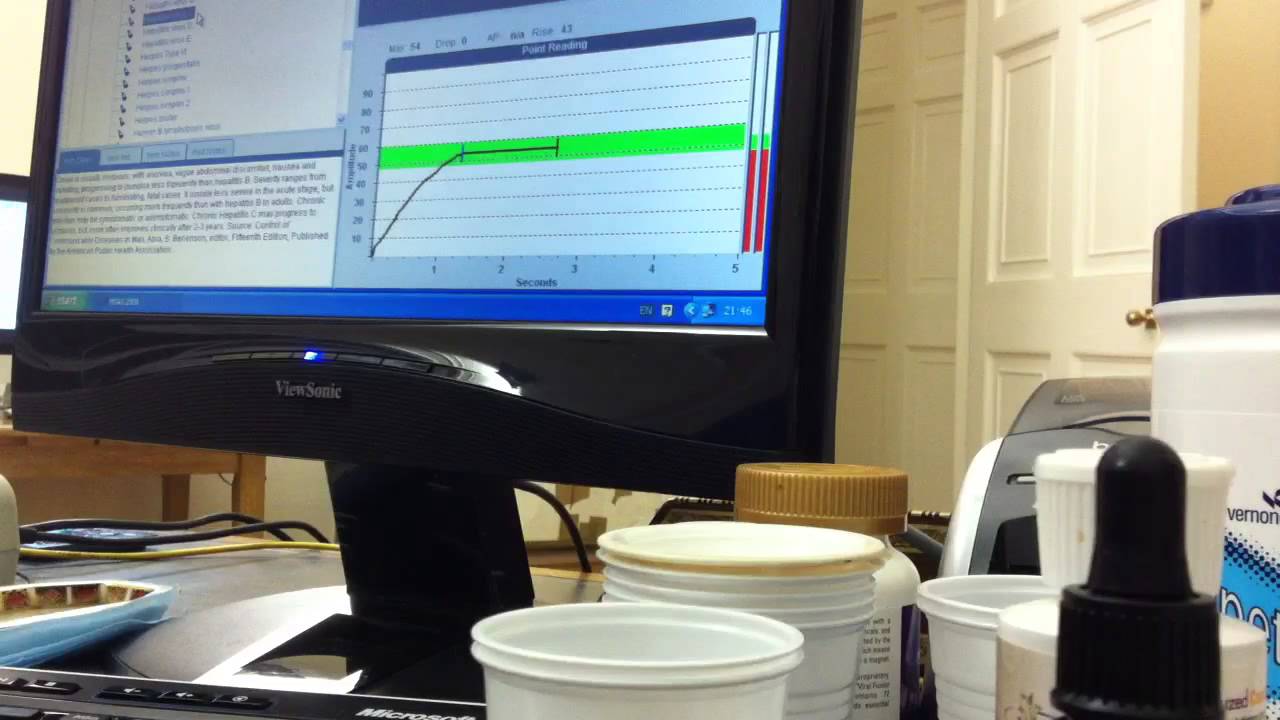 Testing for hepatitis viruses using the BioMeridian computer. El-Essawy ...