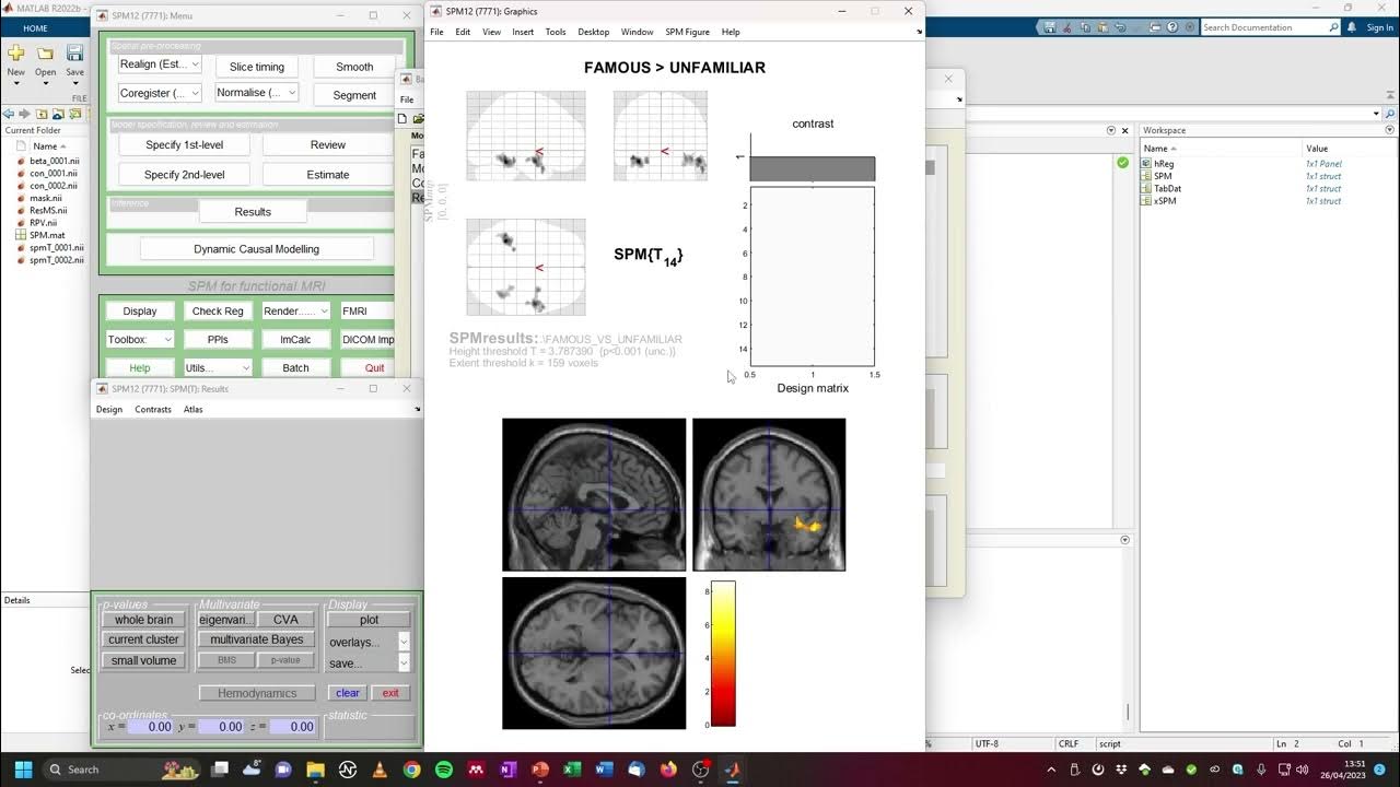 fMRI Analysis with SPM: Second Level Analysis (with GUI) - YouTube