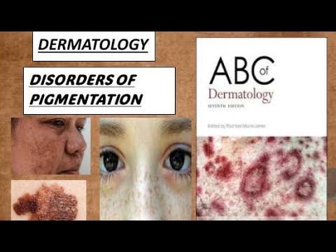 DERMATOLOGY- DISORDERS OF PIGMENTATION #derma #pigmentation #vitiligo # ...